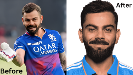 World's Top Cricketers With Hair Transplant - A Hair Case Study