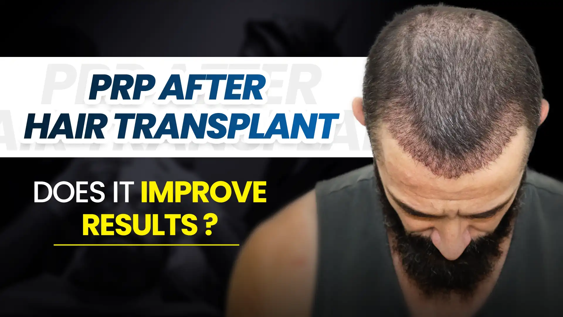 PRP After Hair Transplant – Benefits & Recovery Guide